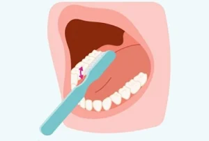 Brushing your teeth, why, when and how - Modbury Dental Practice