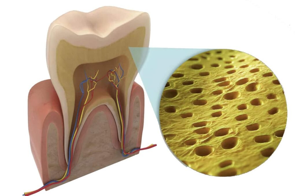 The Stages of Tooth Decay - Modbury Dental Practice